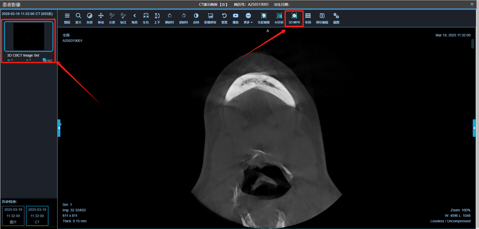 【影像】3D MPR 功能说明-e看牙口腔门诊管理系统