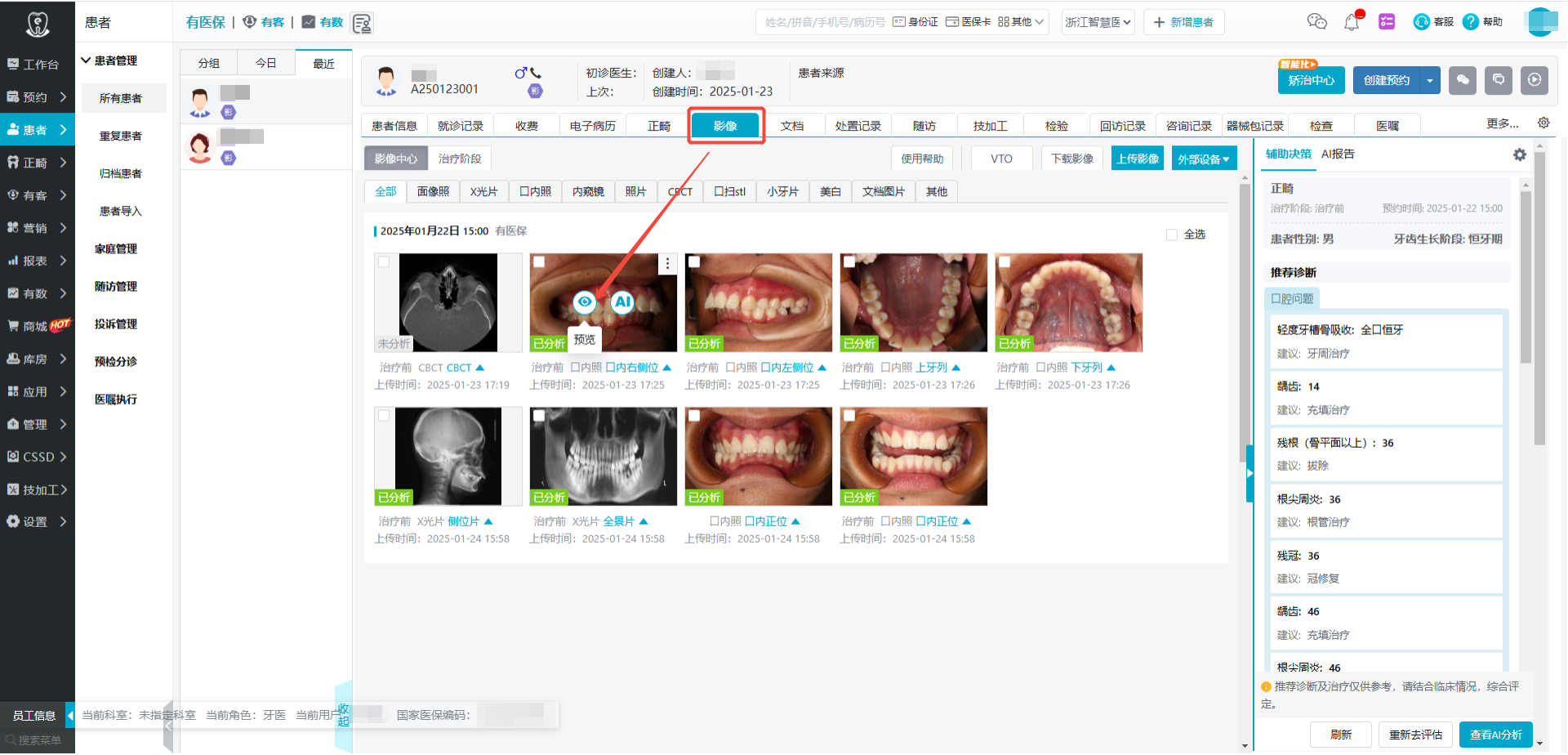 【影像】3D MPR 功能说明-e看牙口腔门诊管理系统