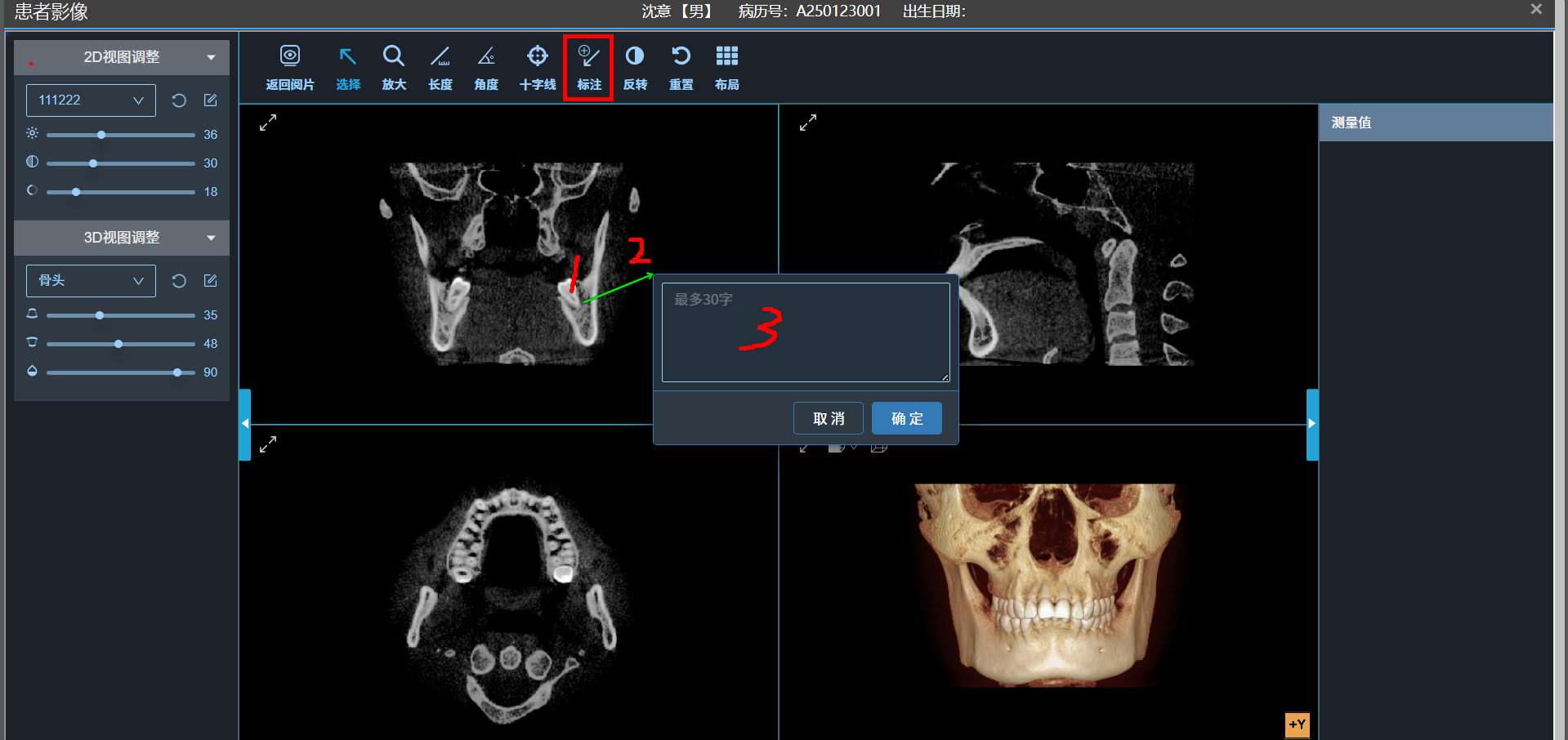 【影像】3D MPR 功能说明-e看牙口腔门诊管理系统