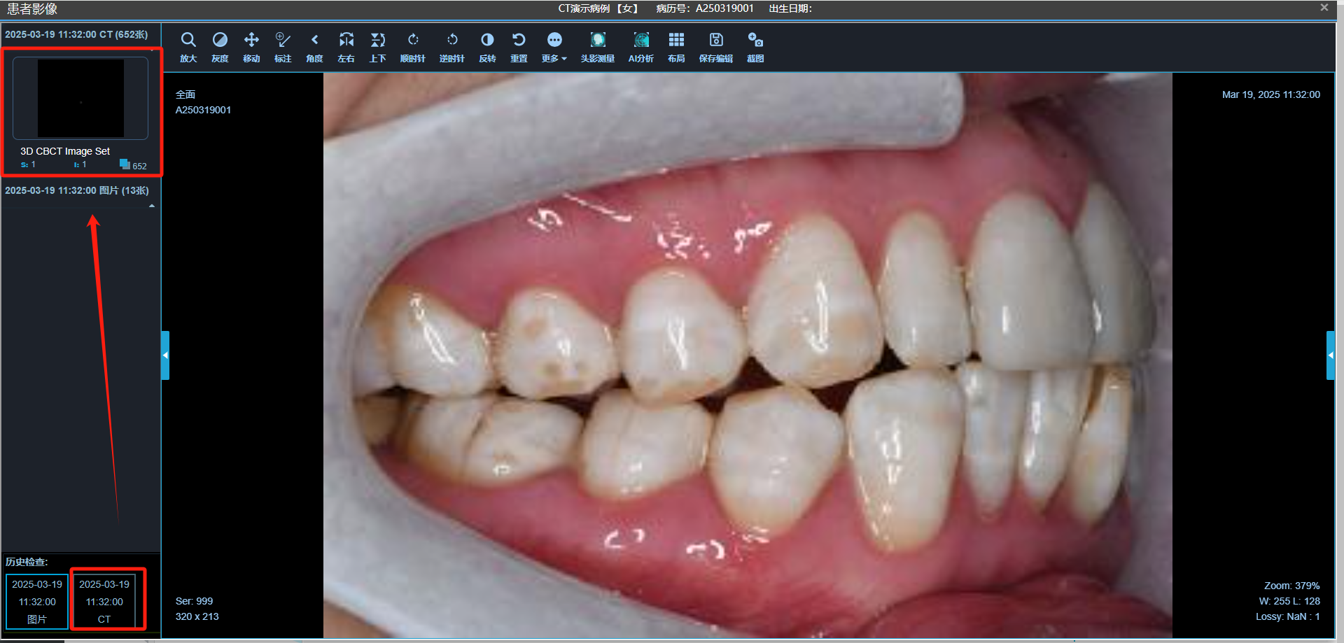 【影像】3D MPR 功能说明-e看牙口腔门诊管理系统
