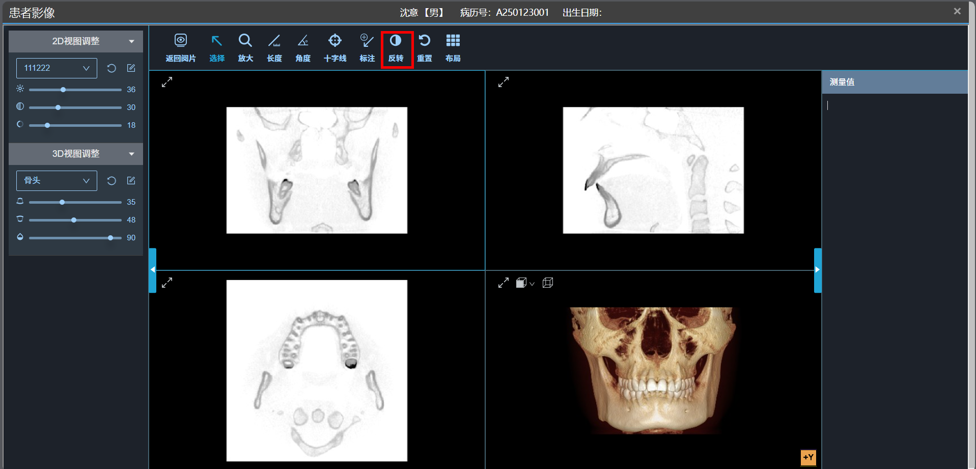 【影像】3D MPR 功能说明-e看牙口腔门诊管理系统