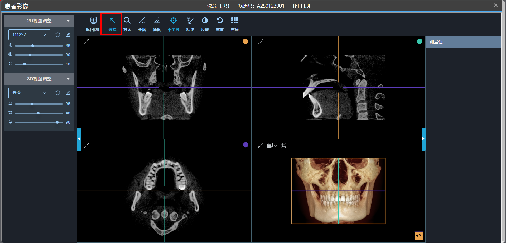 【影像】3D MPR 功能说明-e看牙口腔门诊管理系统
